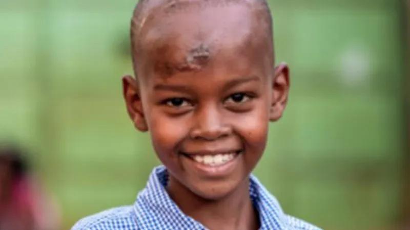 Rare Blood Diseases In Children